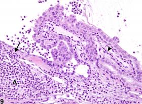 Eye - Inflammation - Nonneoplastic Lesion Atlas