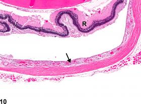 Eye - Inflammation - Nonneoplastic Lesion Atlas