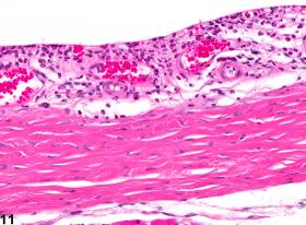 Eye - Inflammation - Nonneoplastic Lesion Atlas