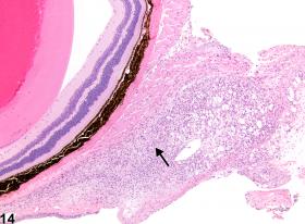 Eye - Inflammation - Nonneoplastic Lesion Atlas