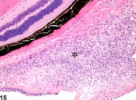 Eye - Inflammation - Nonneoplastic Lesion Atlas