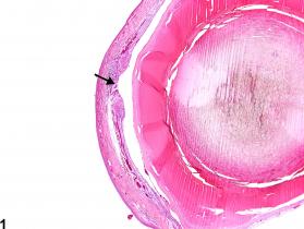 Eye, Iris - Synechia - Nonneoplastic Lesion Atlas