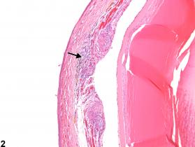 Eye, Iris - Synechia - Nonneoplastic Lesion Atlas