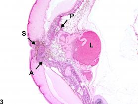 Eye, Iris - Synechia - Nonneoplastic Lesion Atlas