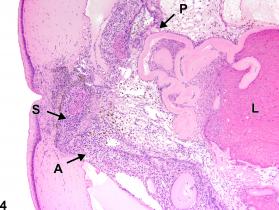 Eye, Iris - Synechia - Nonneoplastic Lesion Atlas