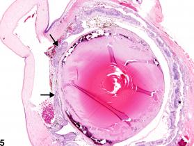 Eye, Iris - Synechia - Nonneoplastic Lesion Atlas