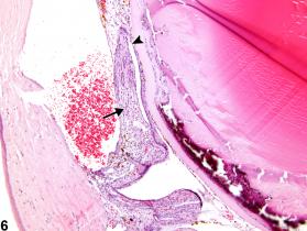 Eye, Iris - Synechia - Nonneoplastic Lesion Atlas