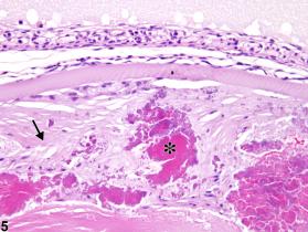 Eye, Lens - Cataract - Nonneoplastic Lesion Atlas