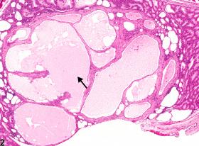 Harderian gland - Cyst - Nonneoplastic Lesion Atlas