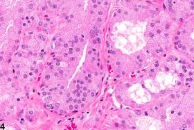 Harderian gland - Hyperplasia - Nonneoplastic Lesion Atlas