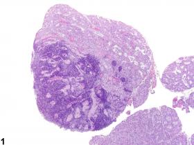 Harderian gland - Inflammation - Nonneoplastic Lesion Atlas