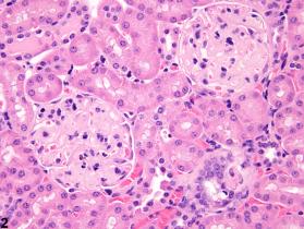 Kidney - Amyloid - Nonneoplastic Lesion Atlas