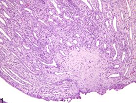 Kidney - Fibrosis - Nonneoplastic Lesion Atlas