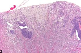 Kidney - Infarct - Nonneoplastic Lesion Atlas