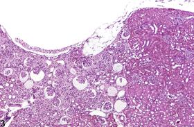Kidney - Infarct - Nonneoplastic Lesion Atlas