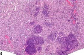 Kidney - Inflammation - Nonneoplastic Lesion Atlas