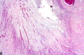 Kidney - Inflammation - Nonneoplastic Lesion Atlas