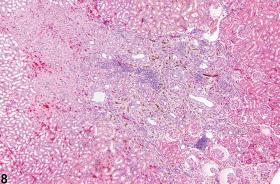 Kidney - Inflammation - Nonneoplastic Lesion Atlas