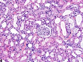 Kidney - Nephropathy, Obstructive - Nonneoplastic Lesion Atlas