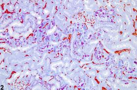 Kidney, Renal Tubule - Accumulation, Hyaline Droplet - Nonneoplastic ...