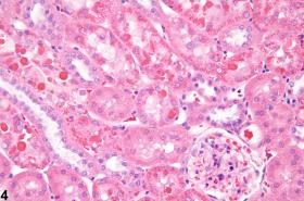 Kidney, Renal Tubule - Accumulation, Hyaline Droplet - Nonneoplastic ...