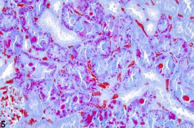 Kidney, Renal Tubule - Accumulation, Hyaline Droplet - Nonneoplastic ...