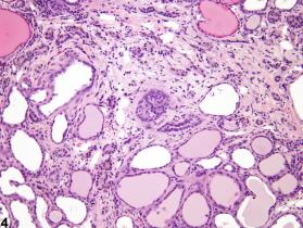 Kidney, Renal Tubule - Dilation - Nonneoplastic Lesion Atlas